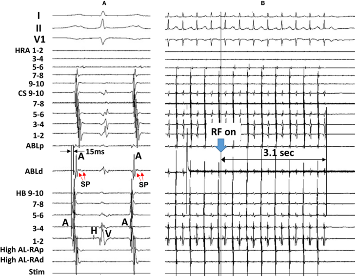 Cms Entrance Conference Worksheet 8 2017 — db-excel.com